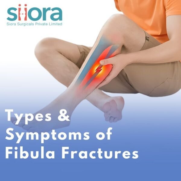 Fibula Fractures - Types & Symptoms