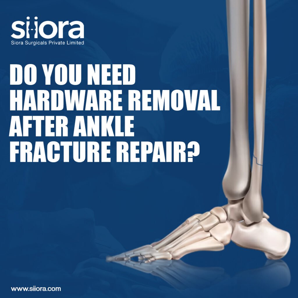 Ankle Fracture Repair - Do you need hardware removal?