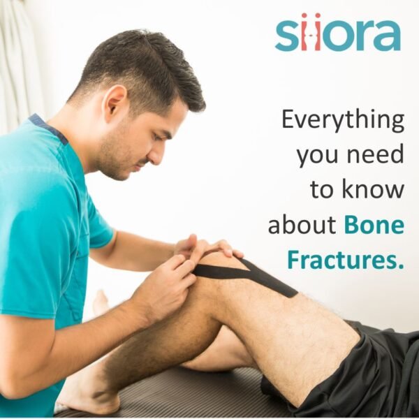 Bone Fractures - Causes, Diagnosis, and Treatment