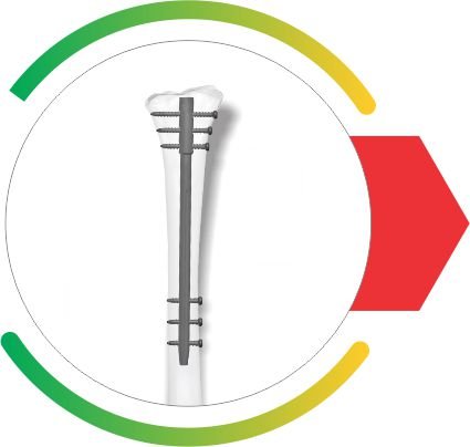 Become an Orthopedic Distributor in Oman