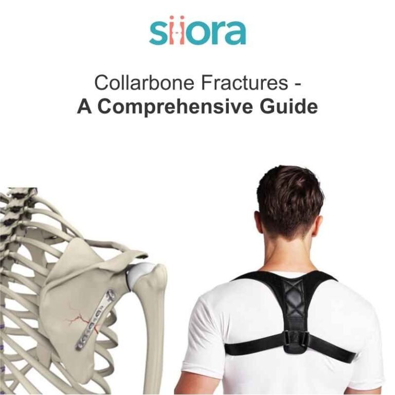 Collarbone Fractures - A Comprehensive Guide - Siora Surgicals Private ...