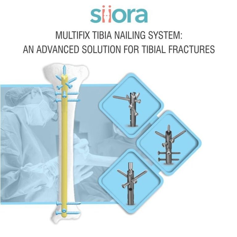 Tibial Fracture Solution: Effective Treatment & Recovery Options