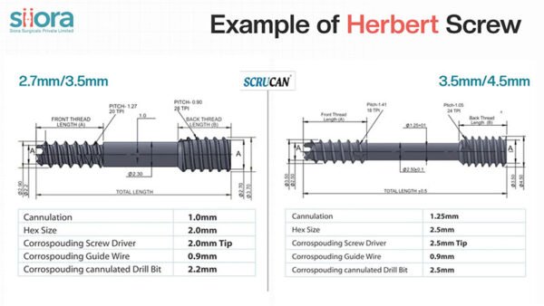Types of Orthopedic Screws: A Comprehensive Guide