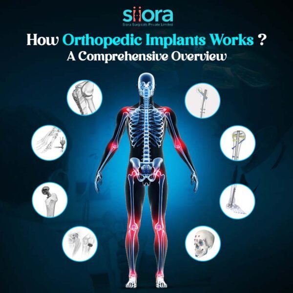 How Orthopedic Implants Work? A Comprehensive Overview
